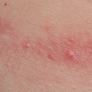 services — Orandi Allergy and Asthma Center
