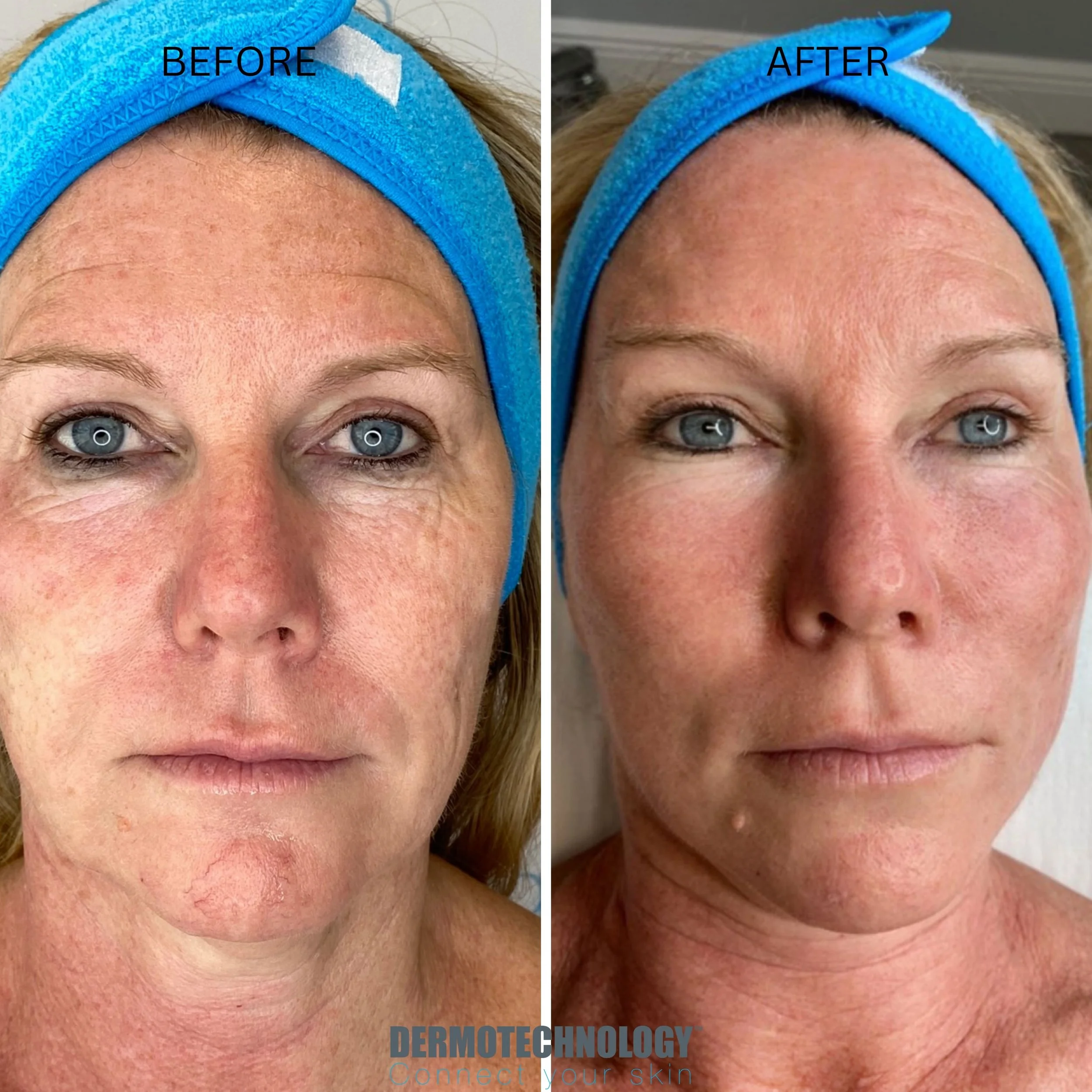 Specials — Freehold Body Care Spa