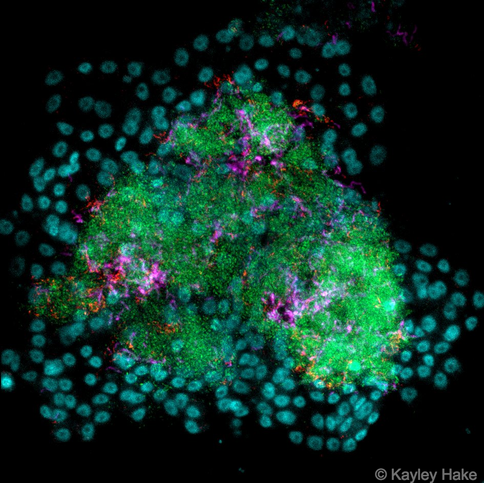 Choanoflagellates Under Microscope
