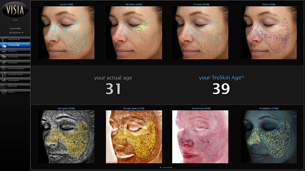 VISIA Skin Analysis — GC Skin Boutique — GC Skin Boutique