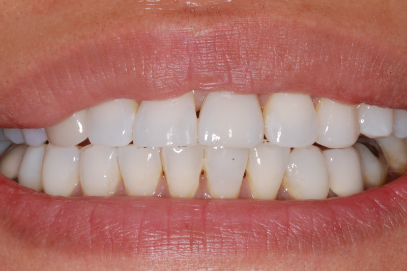 Photo Gallery — Texas Dental Solutions