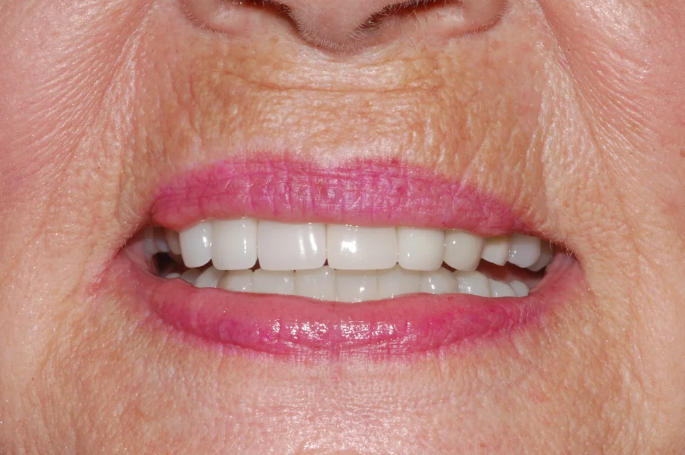 Photo Gallery — Texas Dental Solutions