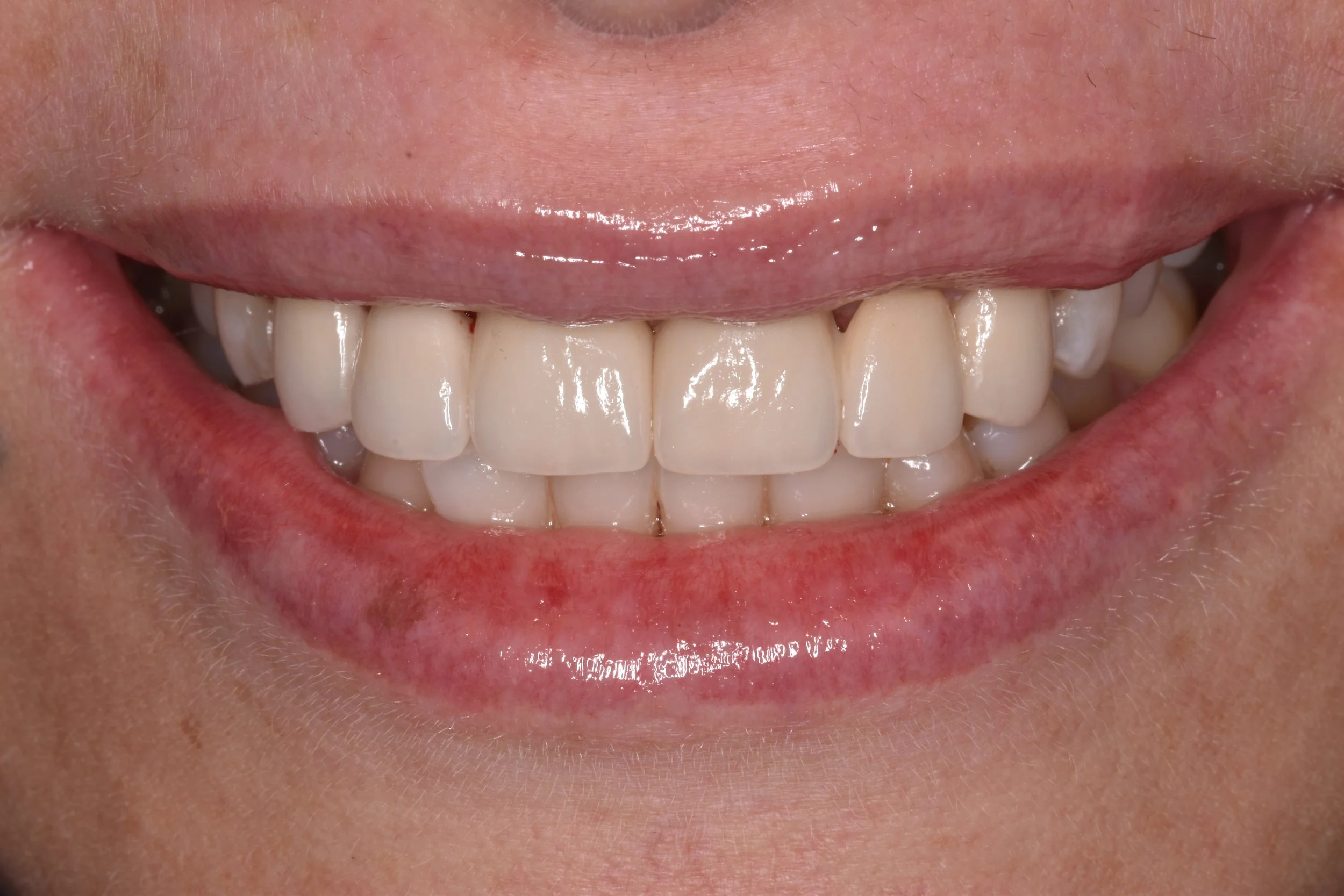 Texas Dental Solutions