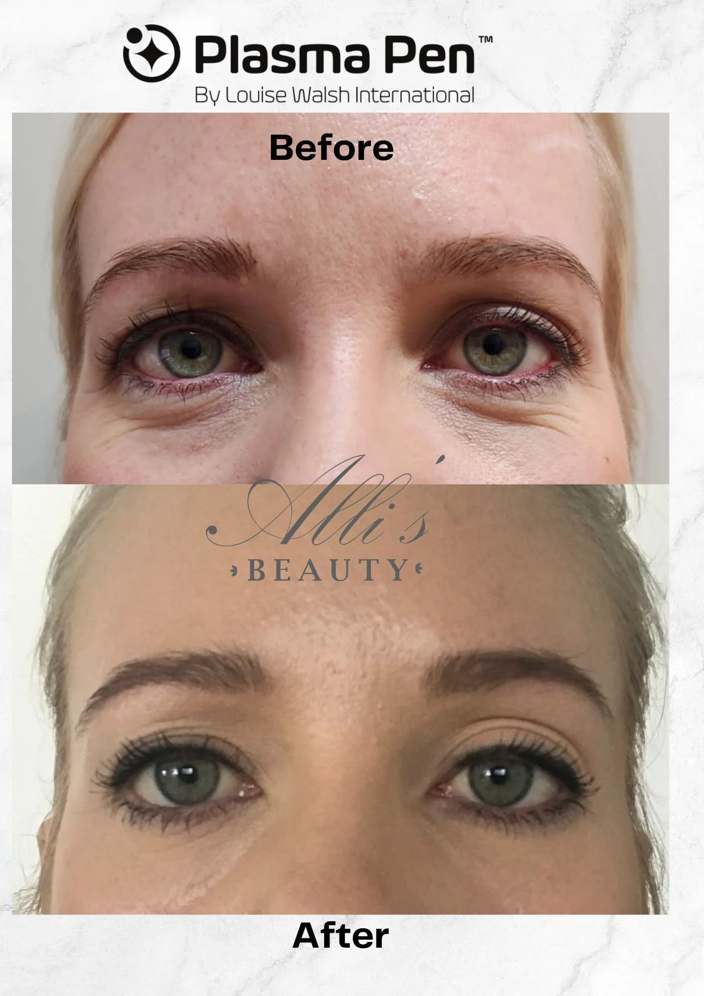 Real Results — Skin Transformations