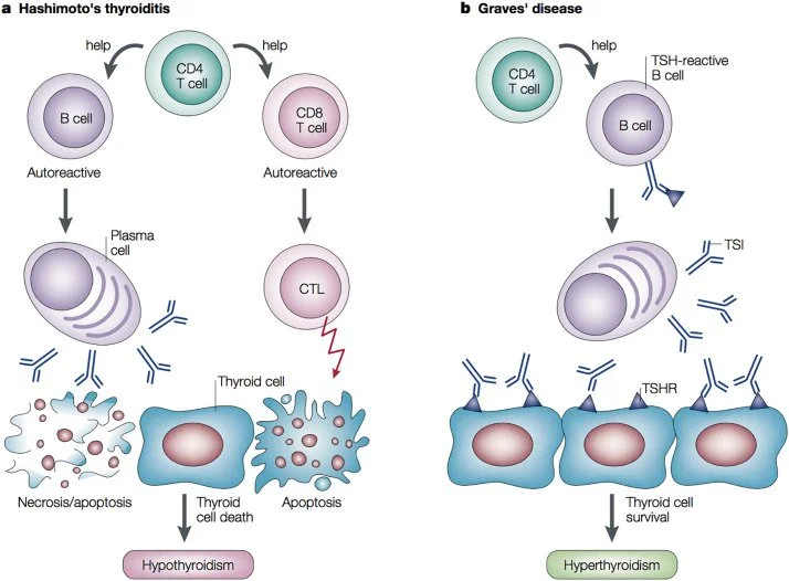 Tiroiditis de Hashimoto — PRIMS Medicina Funcional