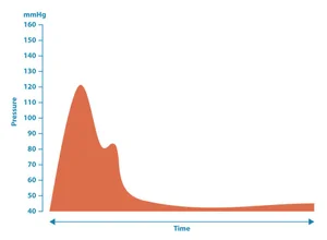 Pulse waveform — Medi-Stats