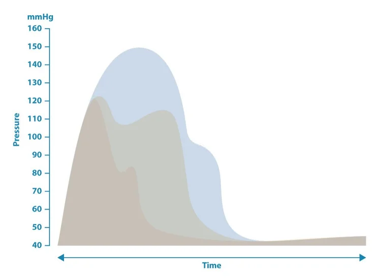 Pulse waveform — Medi-Stats