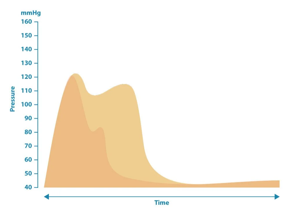 Pulse waveform — Medi-Stats