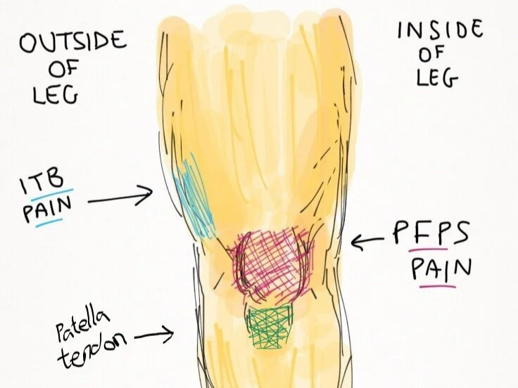 Knee Pain when Running — The Physio & Sports Injury Clinic