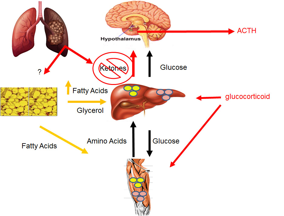Cancer Cachexia — Goncalves Lab