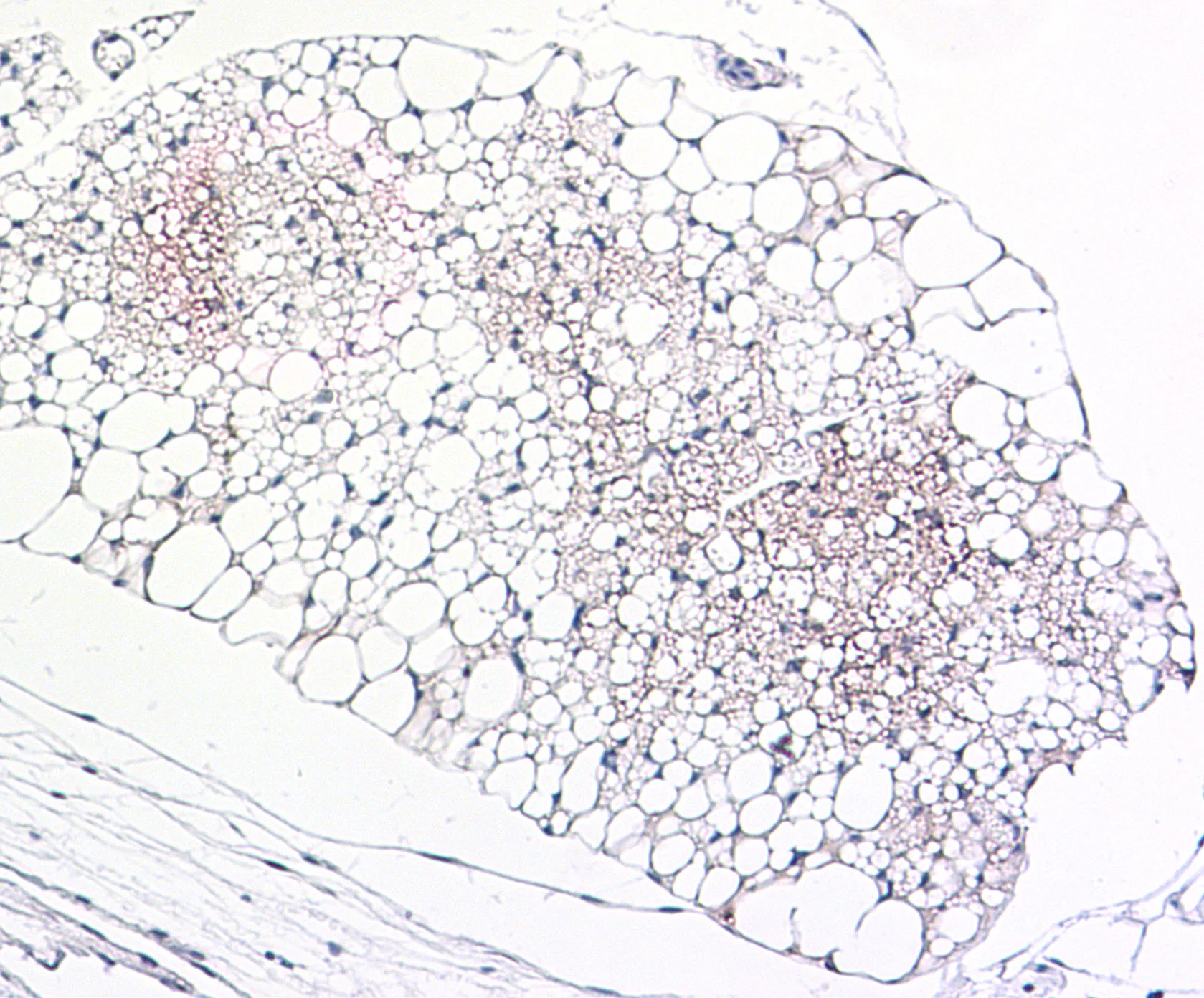 Cancer Cachexia — Goncalves Lab