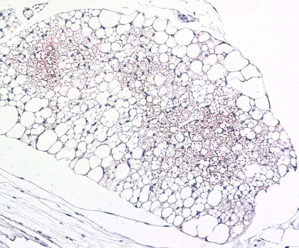 Cancer Cachexia — Goncalves Lab