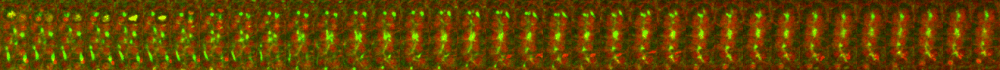 Midbody, Development, Cytokinesis — Bembenek Lab