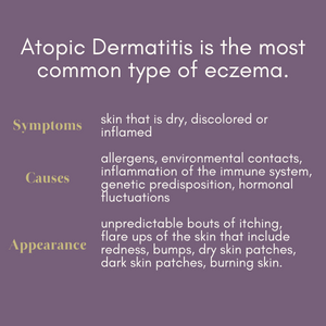 Living with and treating eczema — By Justine