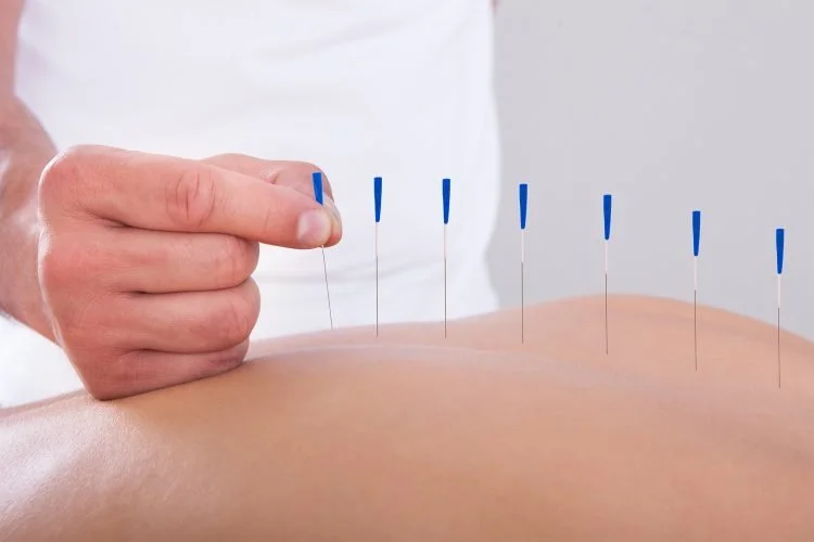 Explore the Different Types of Acupuncture — Mighty River Wellness ...