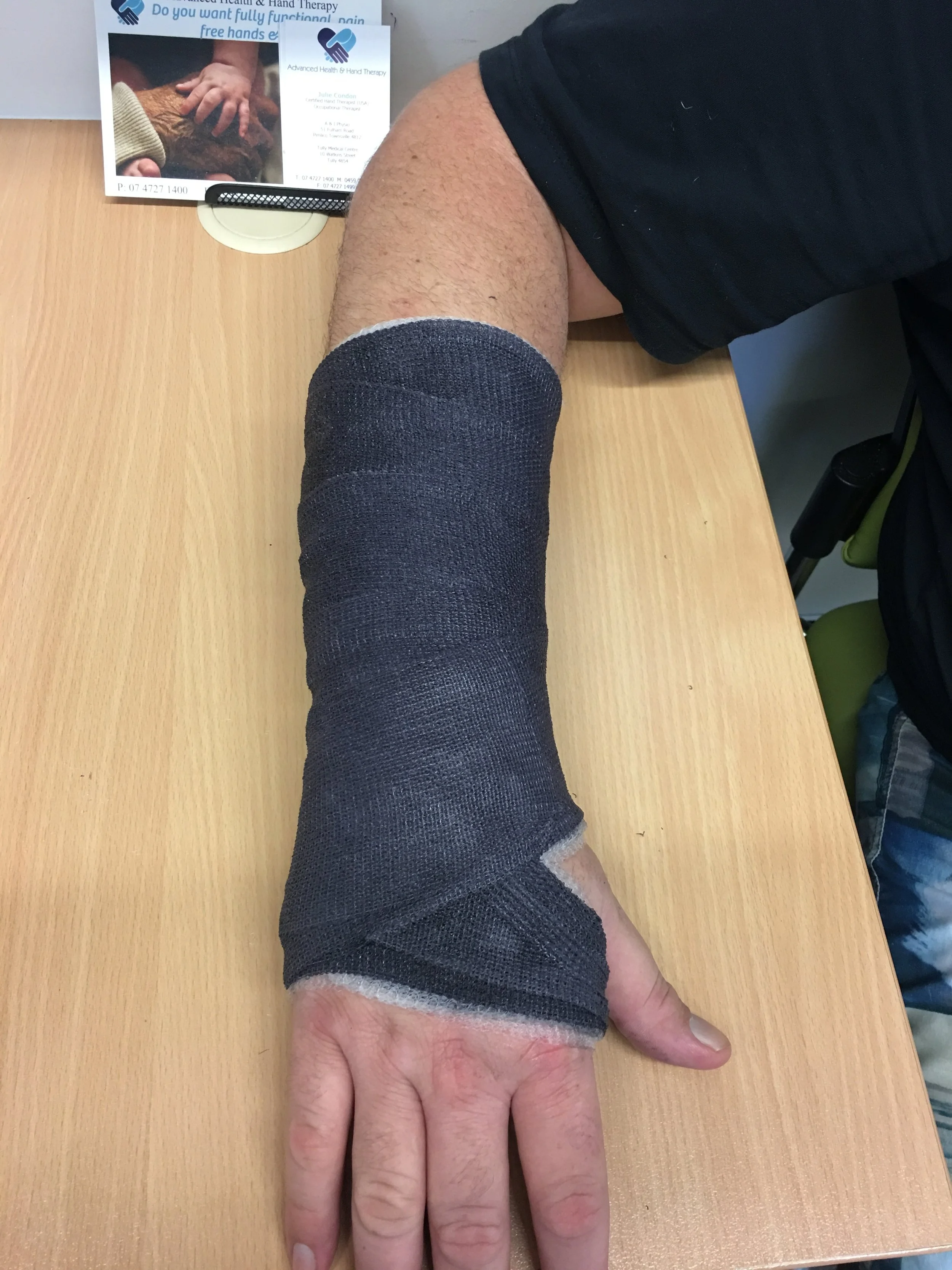 Waterproof Casts — Advanced Health & Hand Therapy