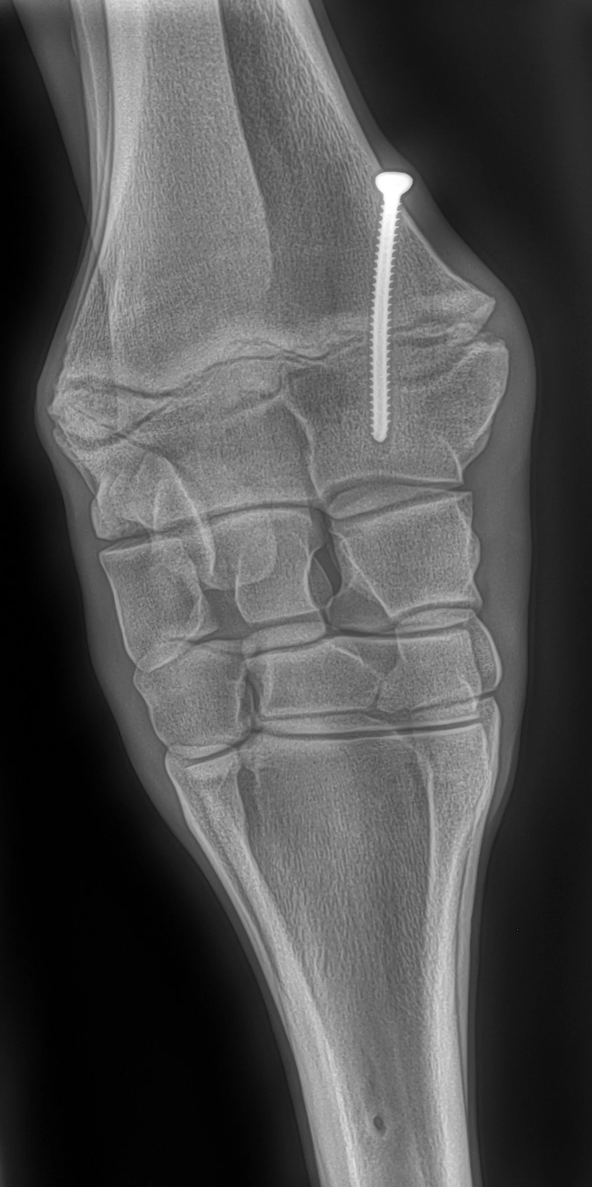 Transphyseal screw placement to correct carpal valgus in a Thoroughbred ...