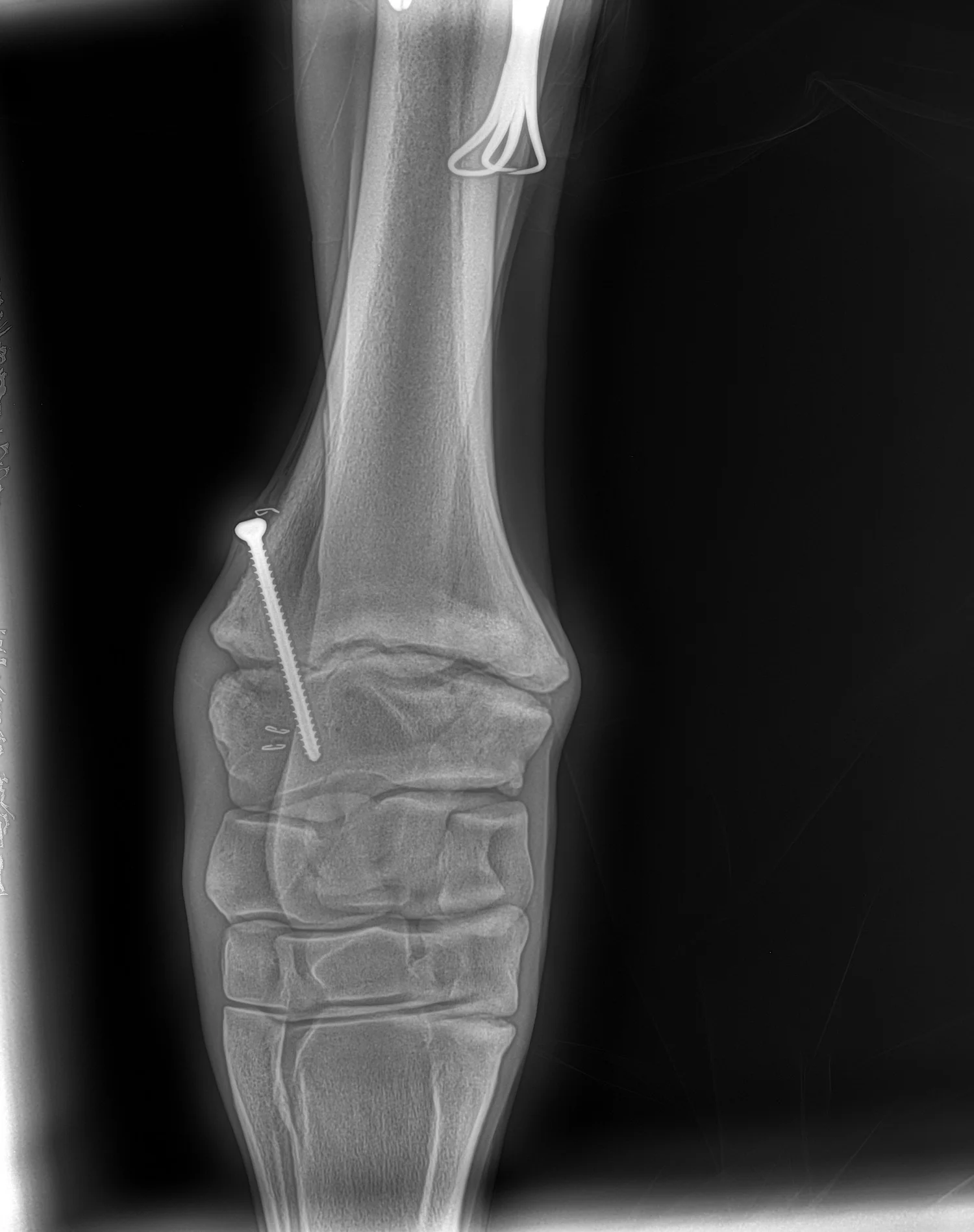 Transphyseal screw placement to correct carpal valgus in a Thoroughbred ...