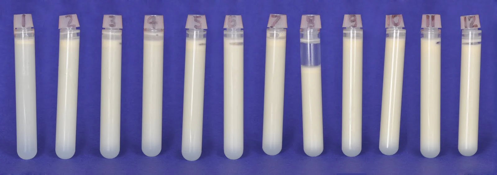 The foremilk/hindmilk misconception — Mattos Lactation