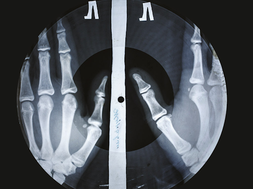 Hologram, Liquid Filled, & X-ray Records, Oh My! — afterglow