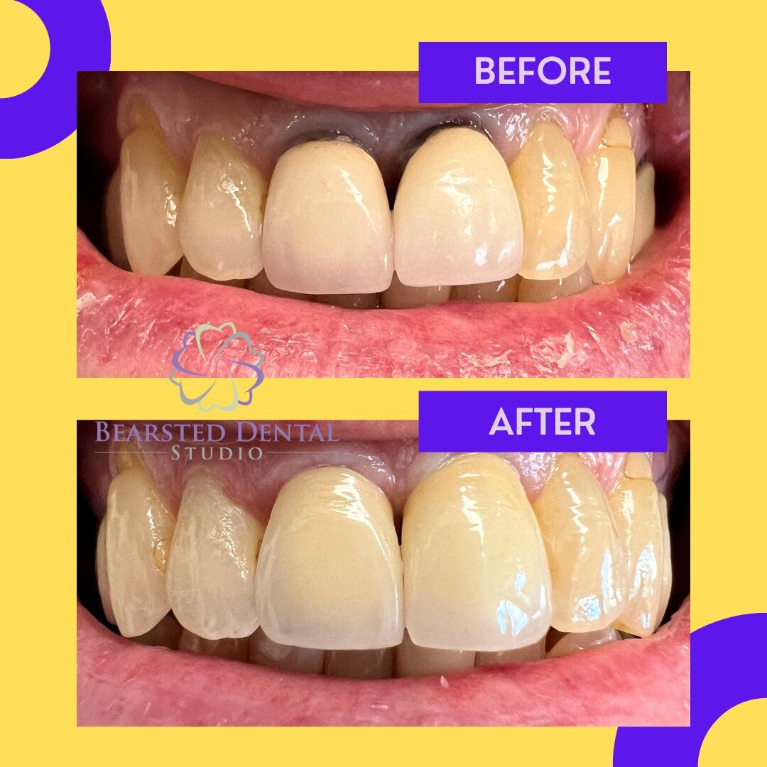 Dentistry and Smile Makeover | Bearsted Dental Studio