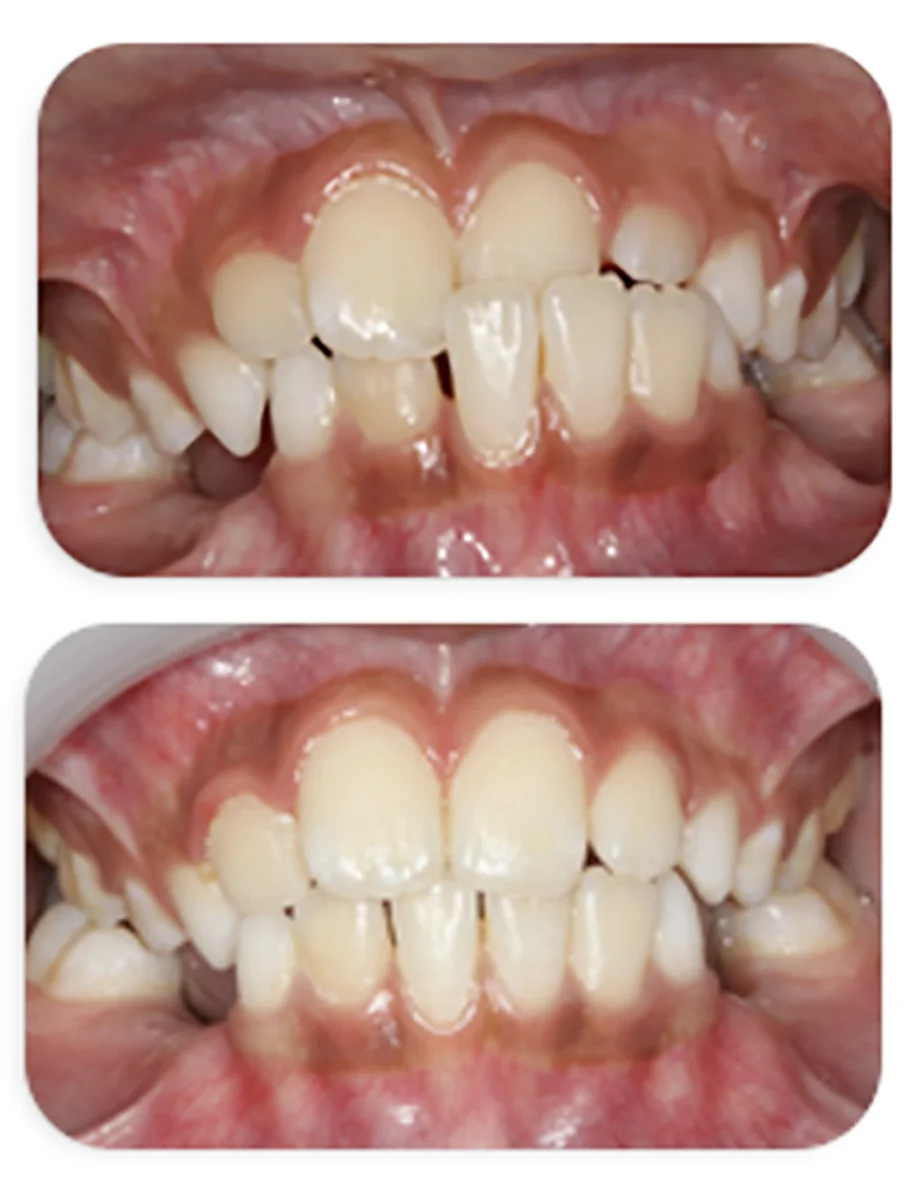 Benefits — Professor Ama Johal