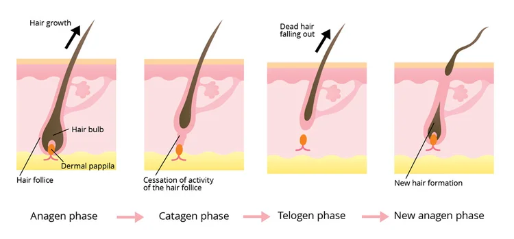 Laser Hair Removal — Aesthetics by Design