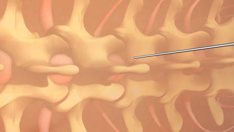 Services — RP Acupuncture