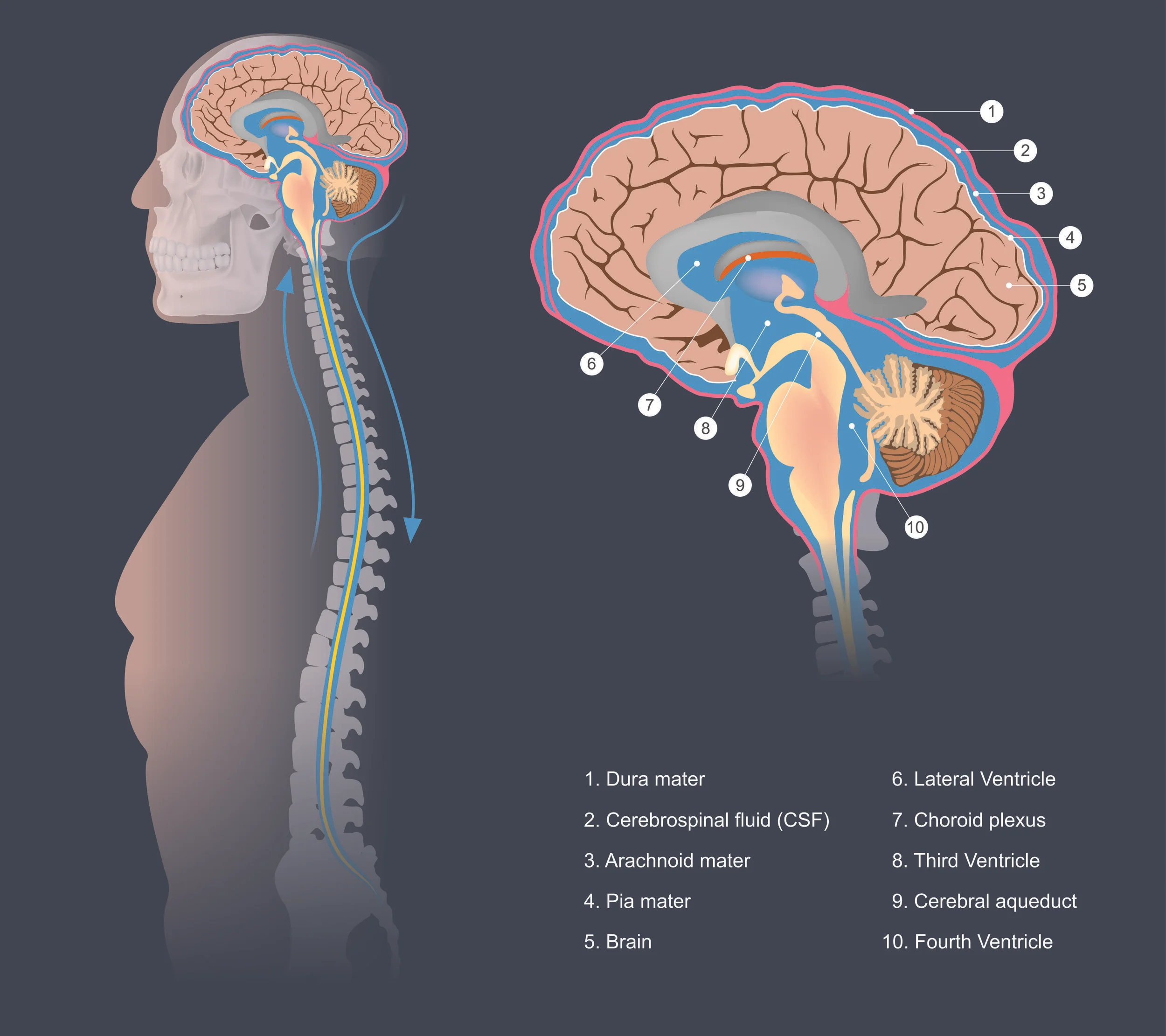 About spinal CSF leak - spontaneous intracranial hypotension — SPINAL CSF LEAK CANADA