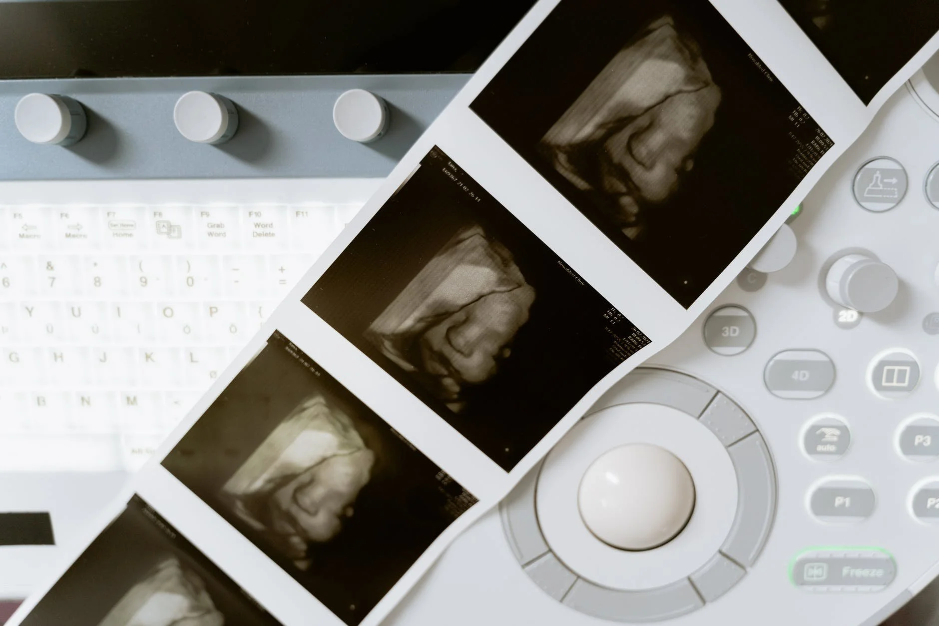 Fetal Development - Options Clinic - Pregnancy Tests, STD Testings, and ...