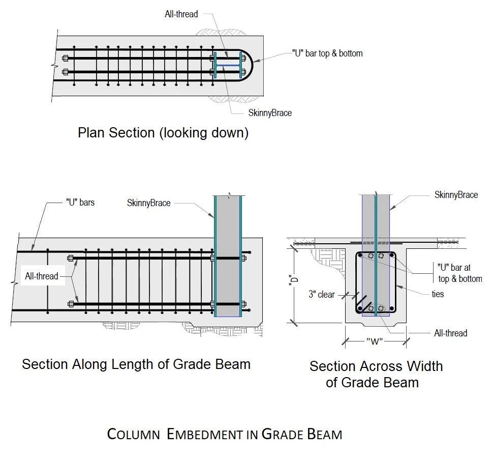 Earthquake Retrofitting | San Francisco Bay Area | SkinnyBraces
