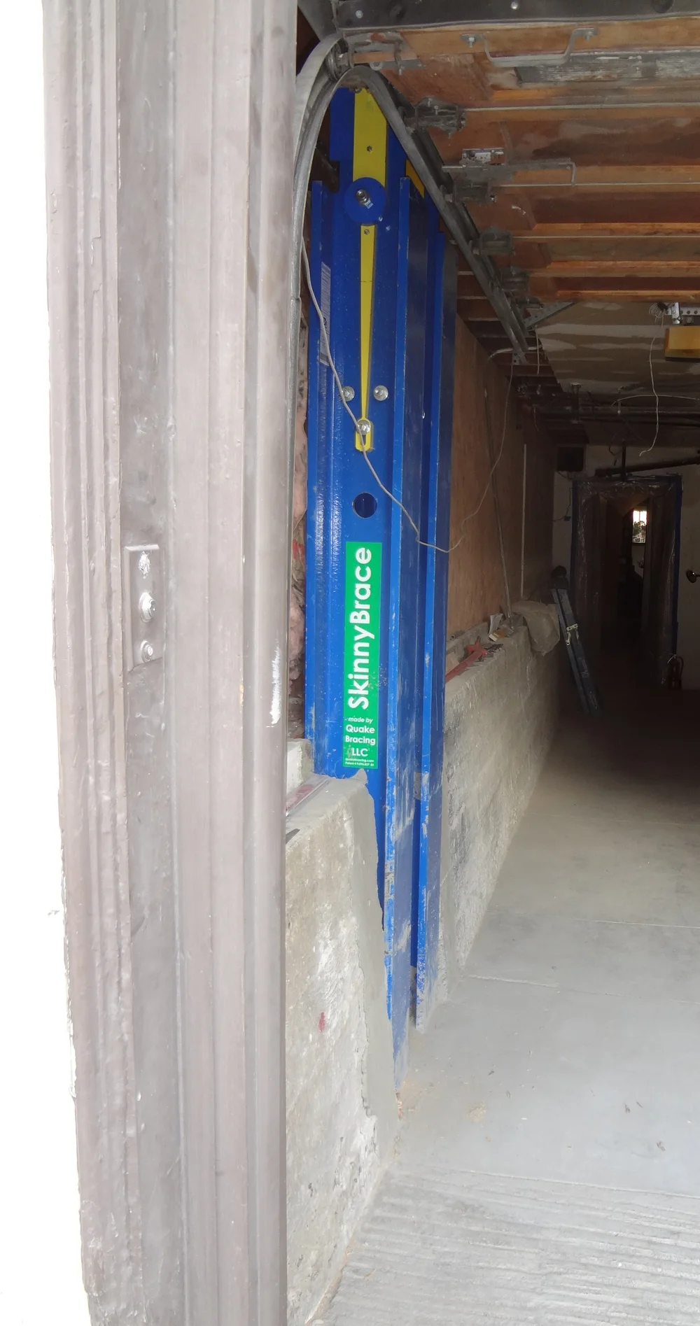 Earthquake Retrofitting | San Francisco Bay Area | SkinnyBraces