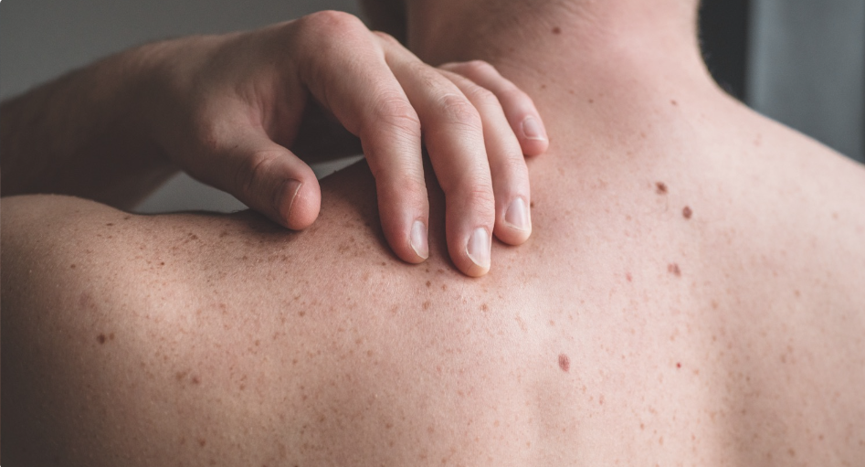 JANUARY - SKIN HEALTH — CIVIC FAMILY HEALTH CARE