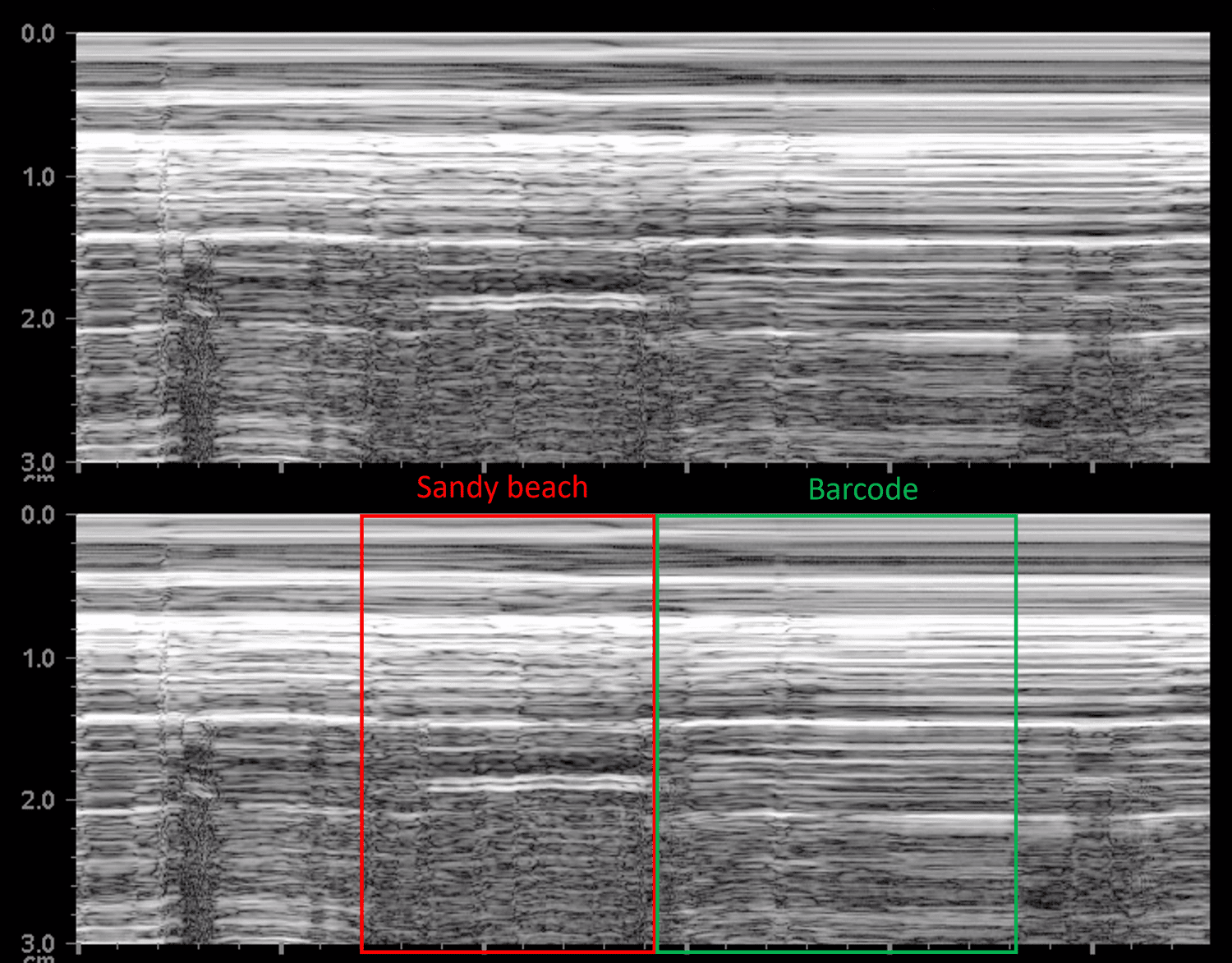 VOTW: Lung Point — Maimonides Emergency Medicine Residency