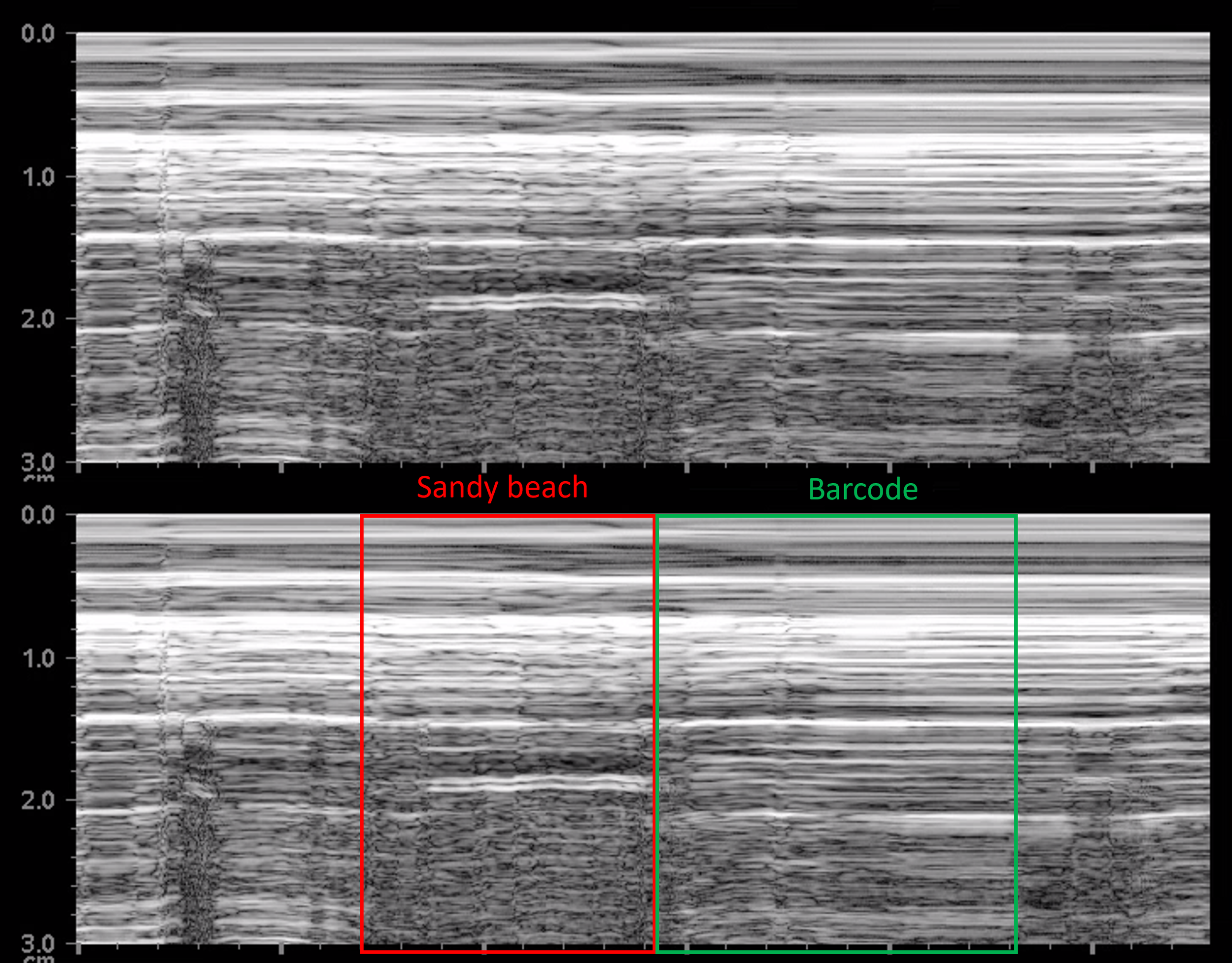 VOTW: Lung Point — Maimonides Emergency Medicine Residency
