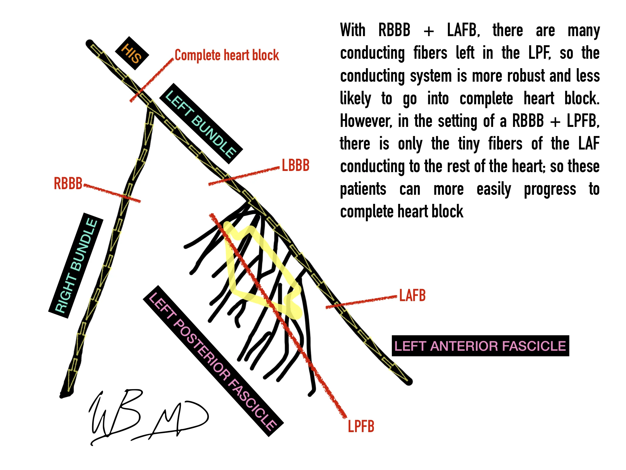 Electrophysiology 101 — Maimonides Emergency Medicine Residency