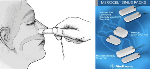 Epistaxis — Maimonides Emergency Medicine Residency