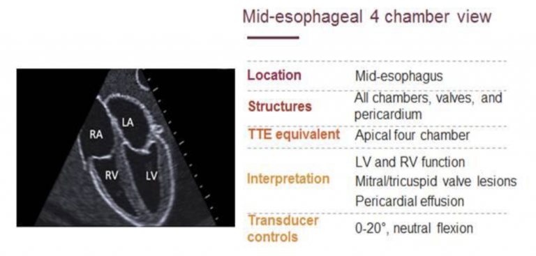 Resuscitative TEE — Maimonides Emergency Medicine Residency