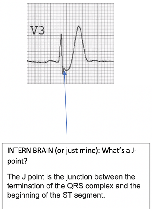 STEMI Equivalents — Maimonides Emergency Medicine Residency