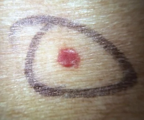 Basics of Dermatology 1 — Maimonides Emergency Medicine Residency