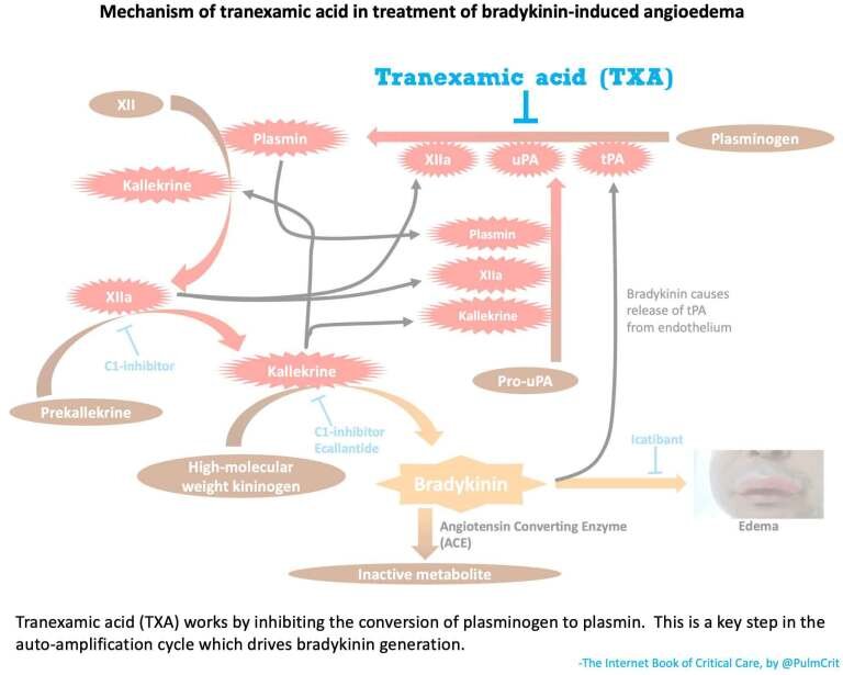 Angioedema — Maimonides Emergency Medicine Residency