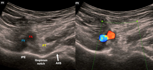 VOTW: Hip, Hip hooray! — Maimonides Emergency Medicine Residency