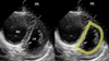 VOTW: “D”-oh! What a heart! — Maimonides Emergency Medicine Residency