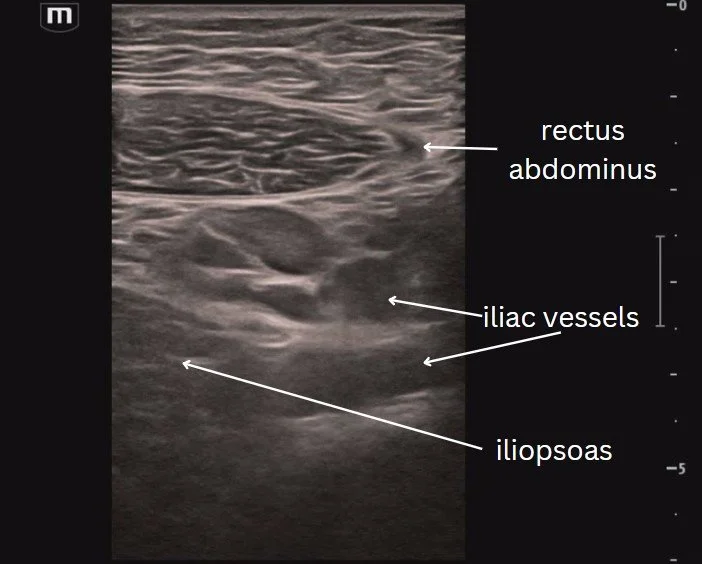 VOTW: Lost my Appy-tite — Maimonides Emergency Medicine Residency