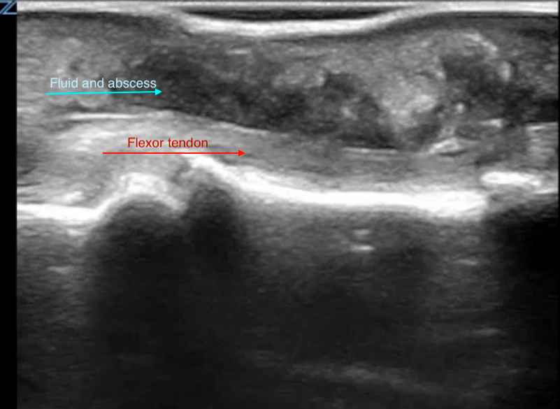 VOTW: Big Flex — Maimonides Emergency Medicine Residency