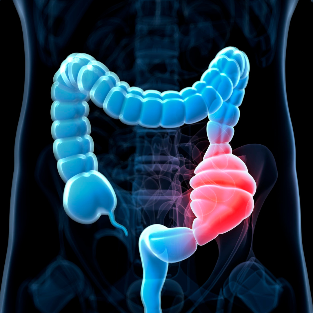 The Constipation Masterclass — Well Belly Health