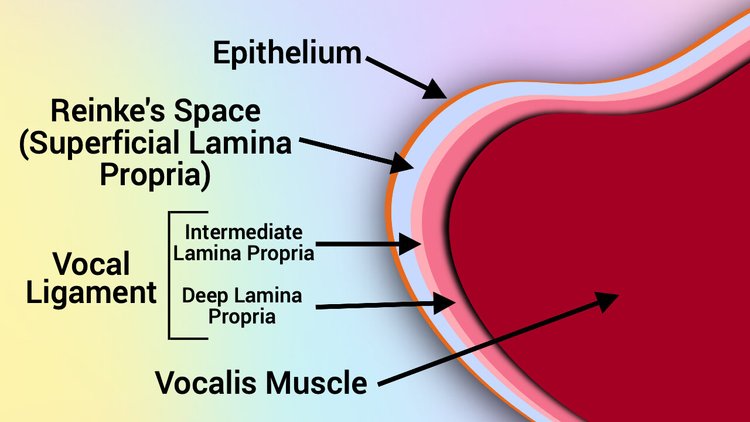 What Happened To Miley Cyrus' Voice and What Is Reinke's Edema? — Beth ...