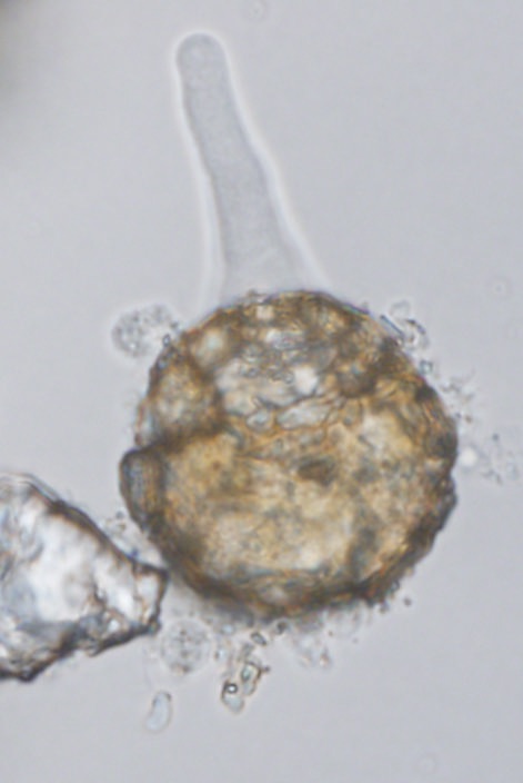 The Many Roles of Protists in the Soil — Global Soil Biodiversity ...