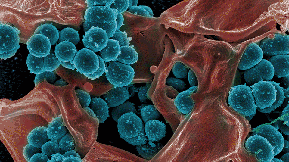 Spectrum Antimicrobials