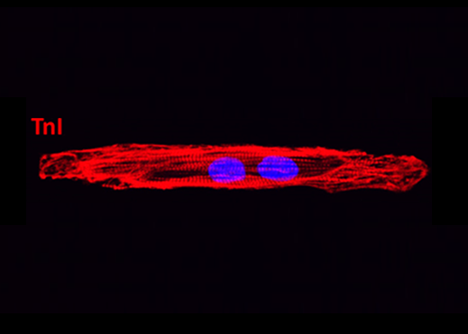 Use CELLvo™ Matrix Plus to maturate and expand hiPSC-CMs — StemBioSys®